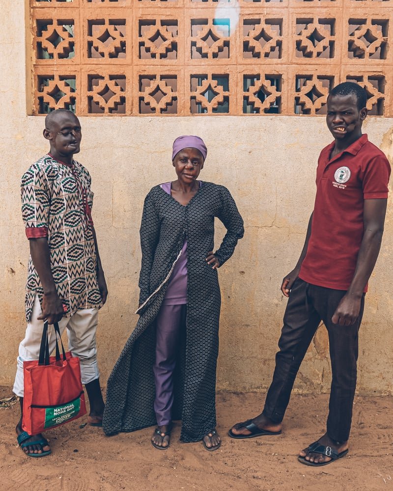 Three survivors of noma, a disease that should no longer exist ...